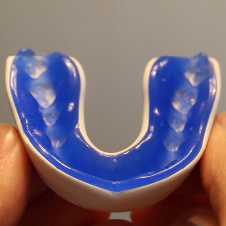 How to Mold a Mouth Guard - Step-by-Step Mouthguard Fitting Guide (with ...